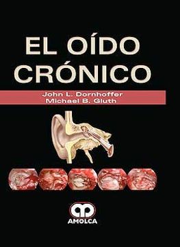 Libro El Oído Crónico De J. - Gluth, M. Dornhoffer - Buscalibre