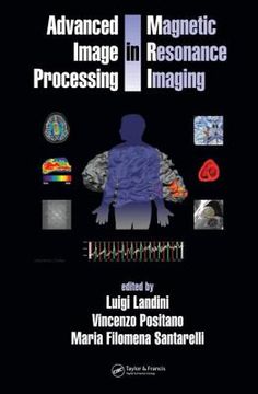 Libro advanced image processing in magnetic resonance imaging (en ...