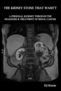 Libro The Kidney Stone That Wasn't: A Personal Journey Through The ...