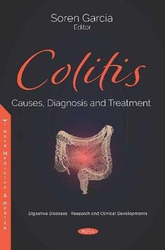 Libro Colitis: Causes, Diagnosis and Treatment (en Inglés) De - Buscalibre