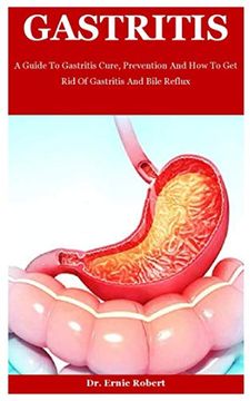 Libro Gastritis: A Guide To Gastritis Cure, Prevention And How To Get Rid Of Gastritis And Bile ...