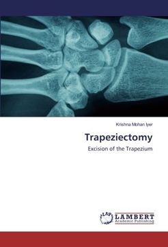 Trapeziectomy
