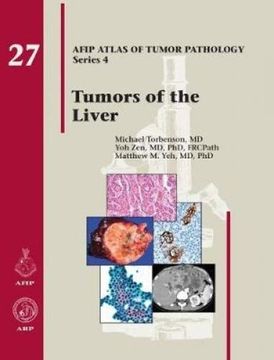 Libro Tumors of the Liver (Afip Atlas of Tumor Pathology, Series 4,) De Michael Torbenson Md ...