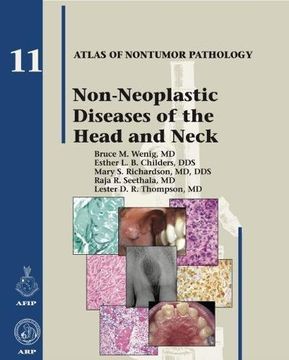 Libro Non-Neoplastic Diseases of the Head and Neck (Atlas of Non-Tumor Pathology, Series 1 ...