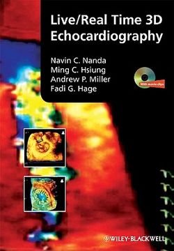 Libro real time 3d transthoracic echocardiography De navin nanda ...