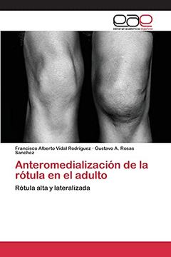 Libro Anteromedialización de la Rótula en el Adulto: Rótula Alta y ...