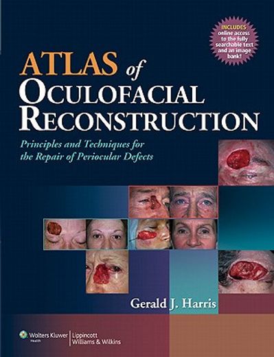 Libro atlas of oculofacial reconstruction,principles and techniques for ...